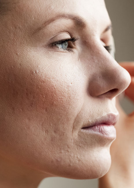 shutterstock_581290531 | Synergie Skin